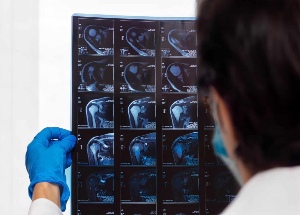 IRM osseuse | Centre de radiologie | Olympe Imagerie | Antony