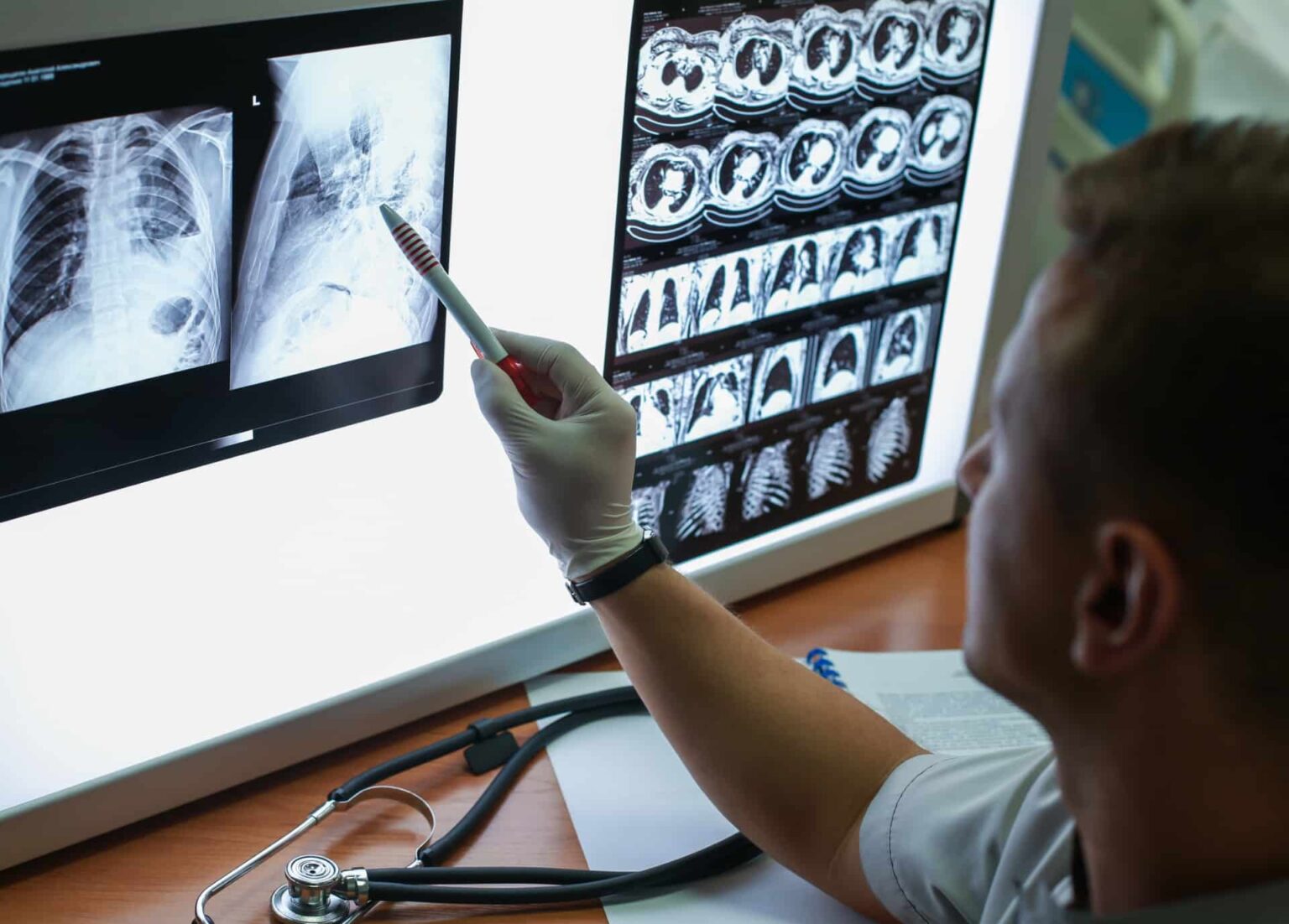 Scanner thoracique | Centre de radiologie | Olympe Imagerie | Antony