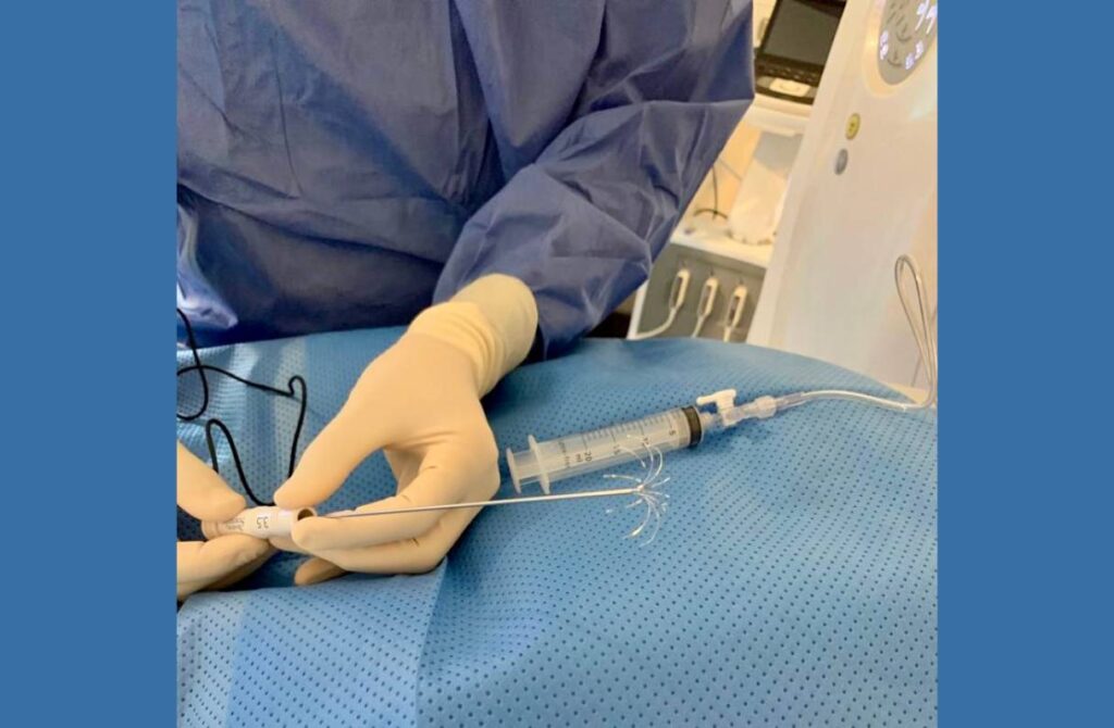 Oncologie interventionnelle : une nouvelle solution pour traiter le cancer - Olympe Imagerie