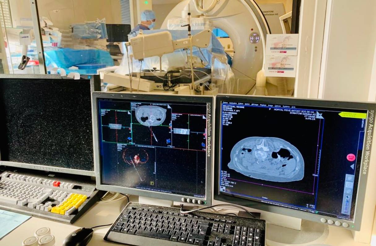 Oncologie interventionnelle : une nouvelle solution pour traiter le cancer - Olympe Imagerie